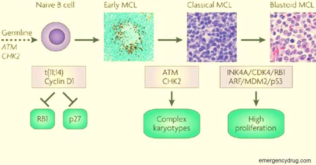 Mantle cell lymphoma - Emergency Drug - lymphoma