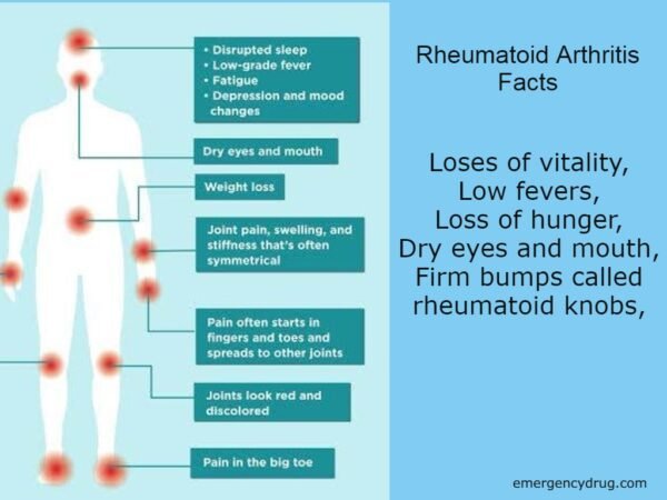 Rheumatoid Arthritis Facts - Emergency Drug